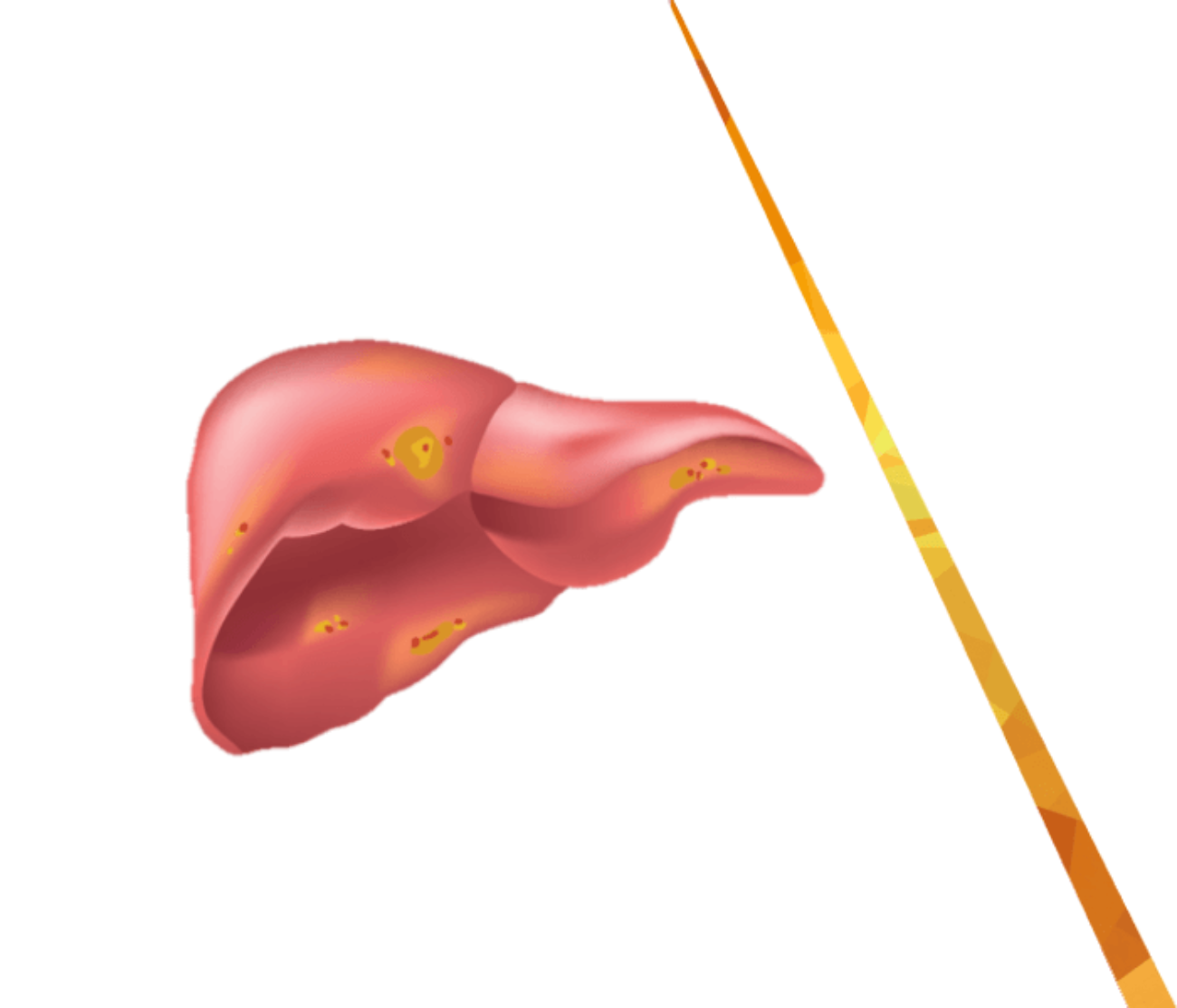 Comienza a cuidar tu hígado con Esencial®