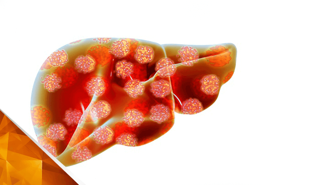 Causas y tratamientos para la Hepatitis B y C